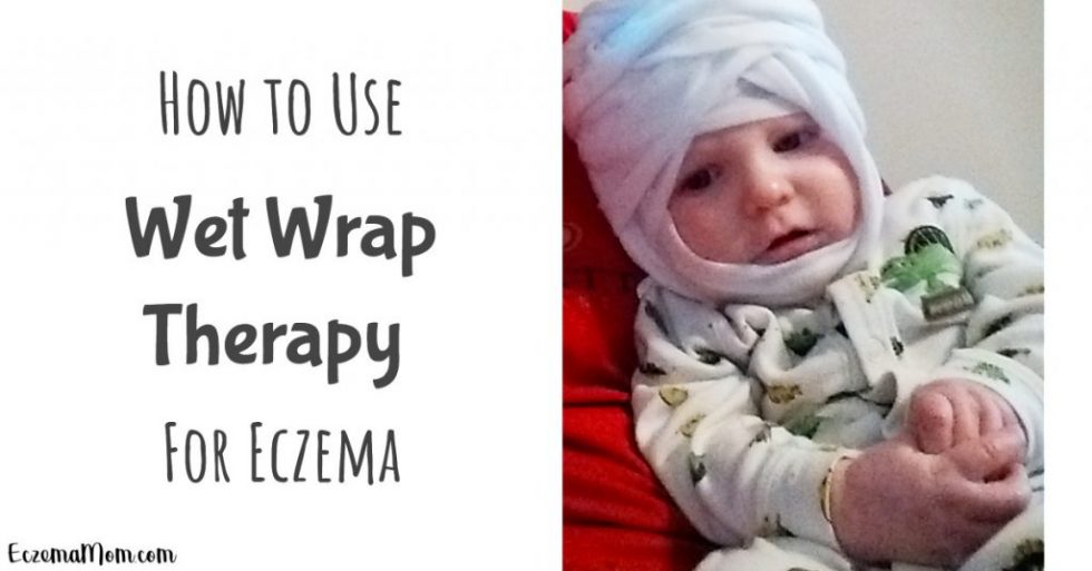 How to Use Wet Wrap Therapy for Eczema - ilovenatural.store